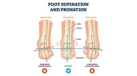 How to Know Your Pronation and the Support You Need – Footwear etc.